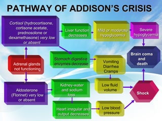 Adrenal Disorders. Addison’s Crisis | PPT