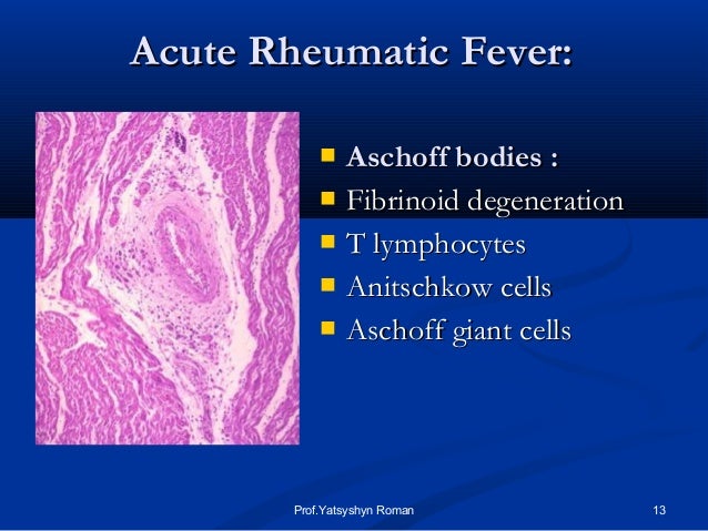 Rheumatic Fever