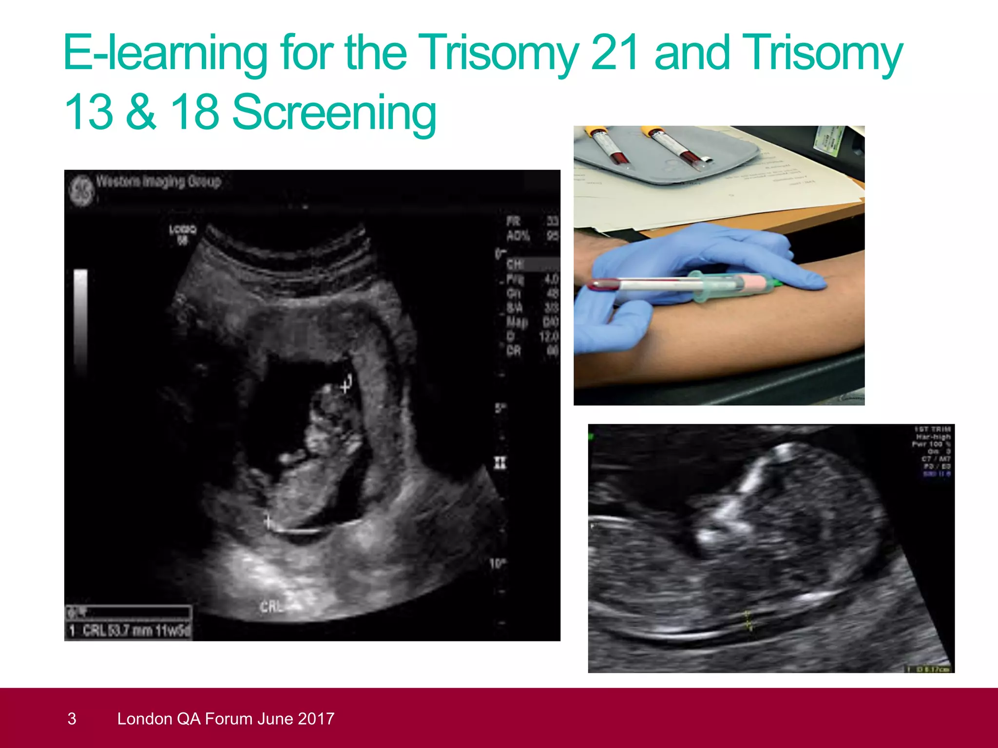 4. FASP e learning | PDF