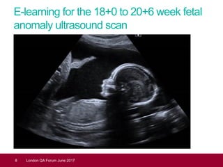 4. FASP e learning | PDF