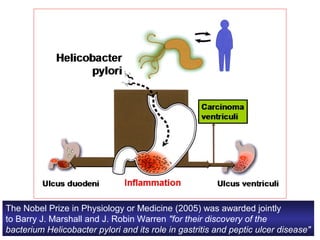Drugs affecting Gastro Intestinal function | PPT | Digestive Disorders ...