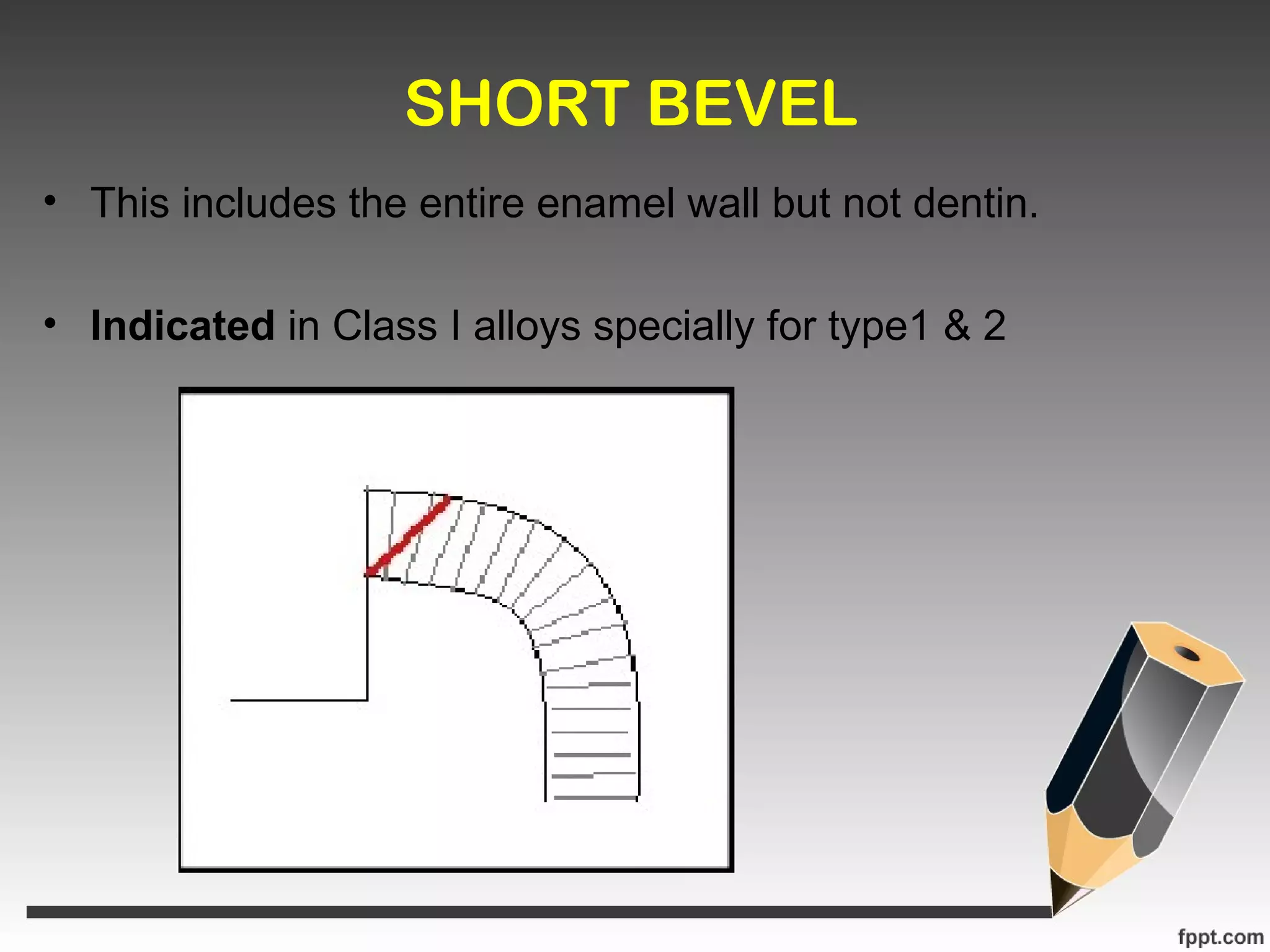 Bevels and flares in dental restoration | PPT
