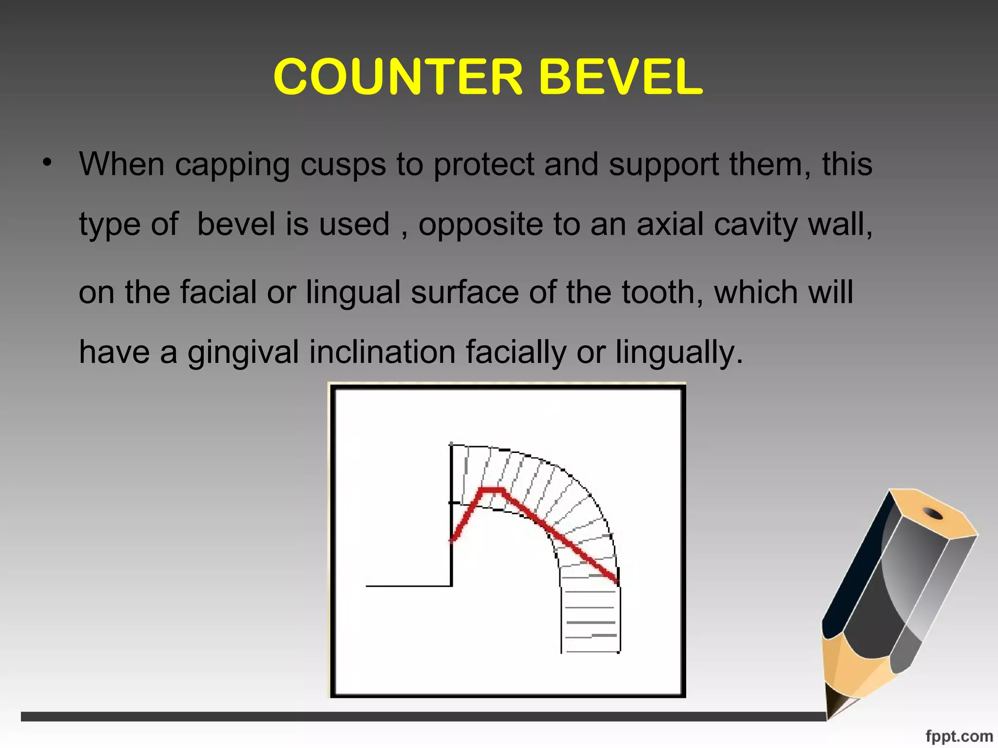 Bevels and flares in dental restoration | PPT