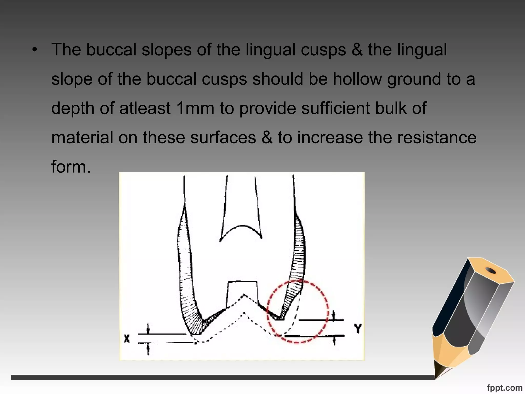 Bevels and flares in dental restoration | PPT