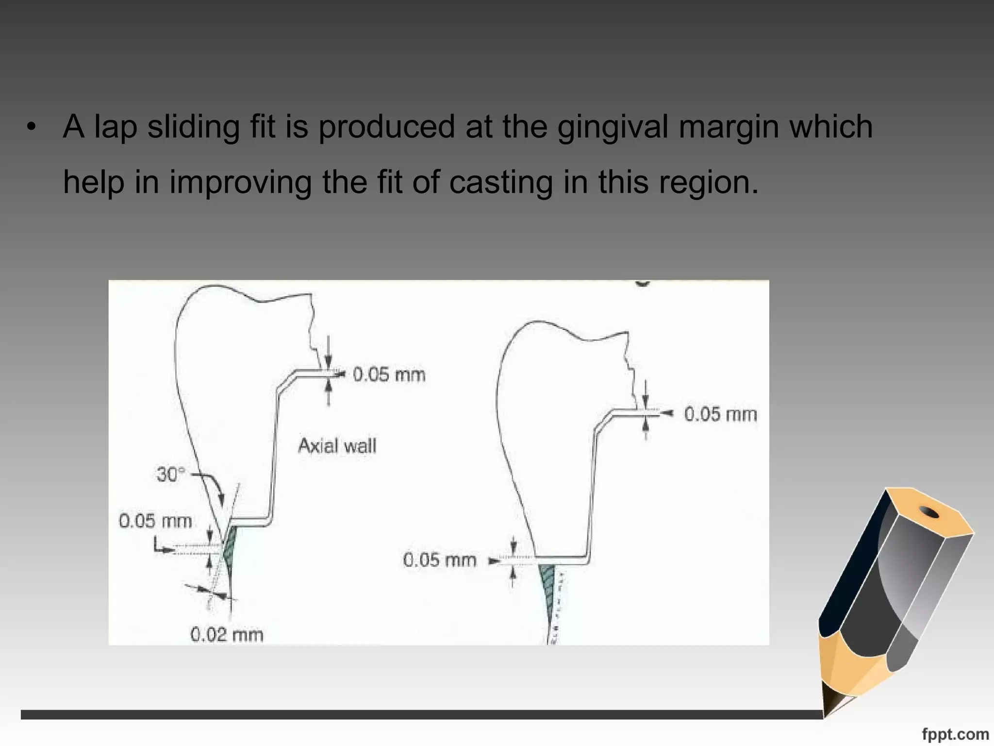 Bevels and flares in dental restoration | PPT