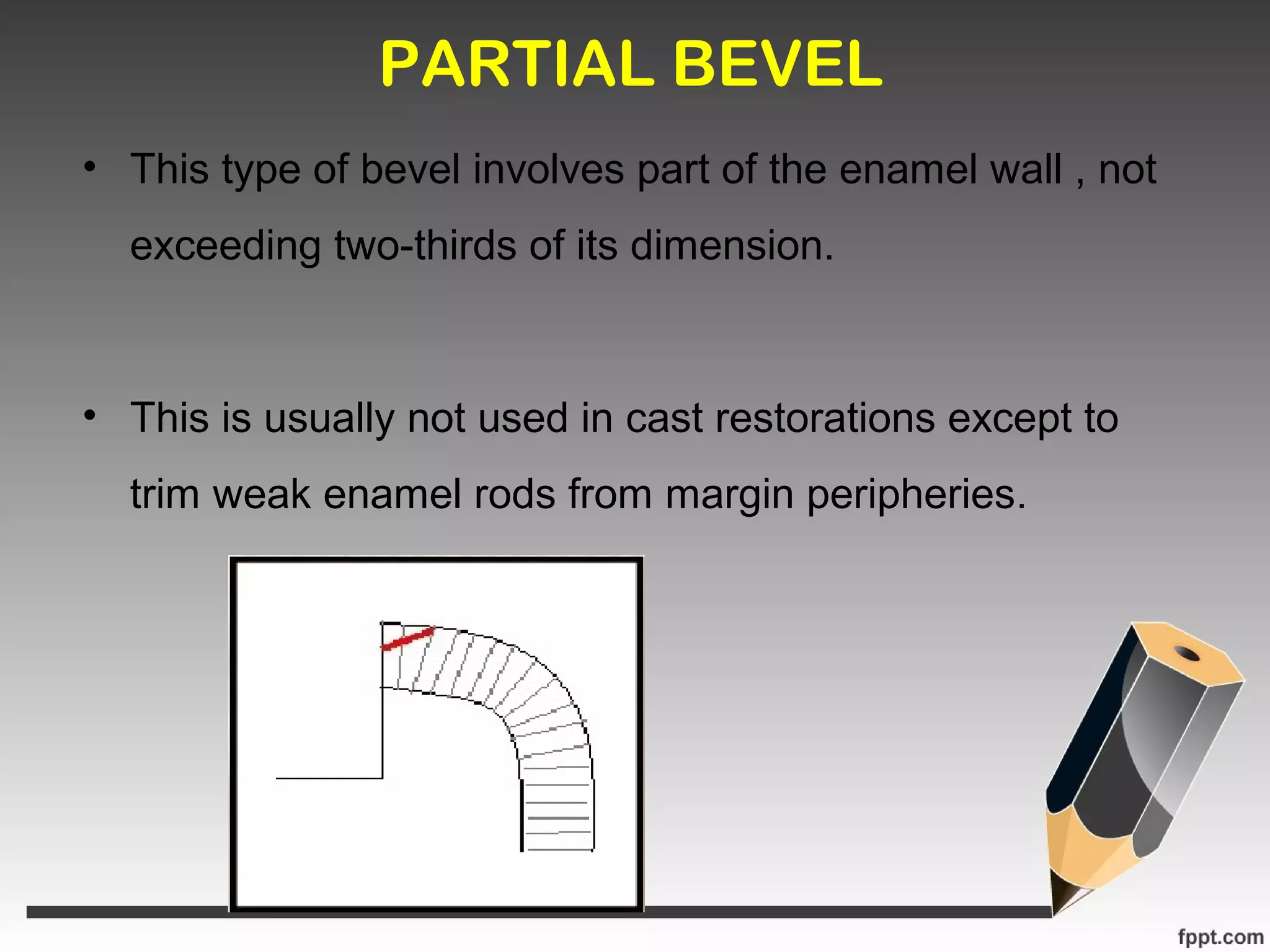 Bevels and flares in dental restoration | PPT