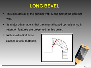 Bevels and flares in dental restoration | PPT