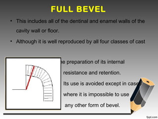 Bevels and flares in dental restoration | PPT