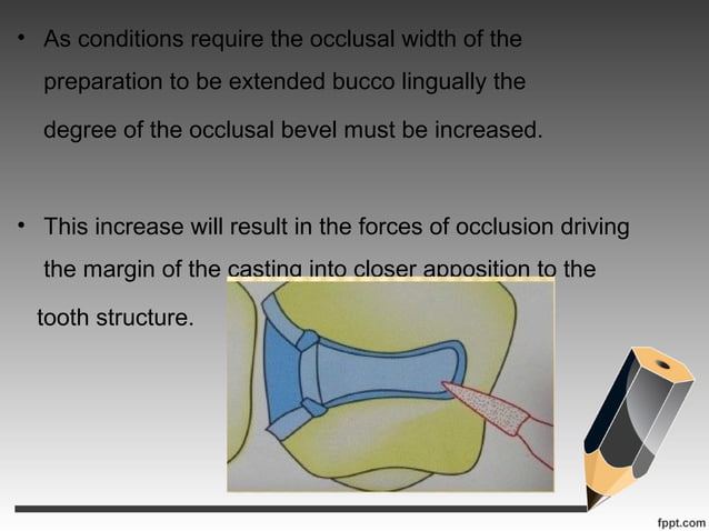 Bevels and flares in dental restoration | PPT | Dental Health ...