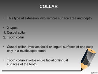 Bevels and flares in dental restoration | PPT