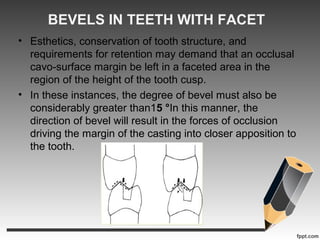 Bevels and flares in dental restoration | PPT