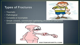 4. healing and fracture | PPTX