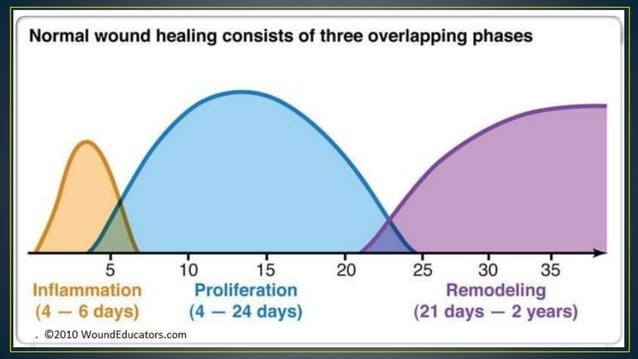 4. healing and fracture | PPT