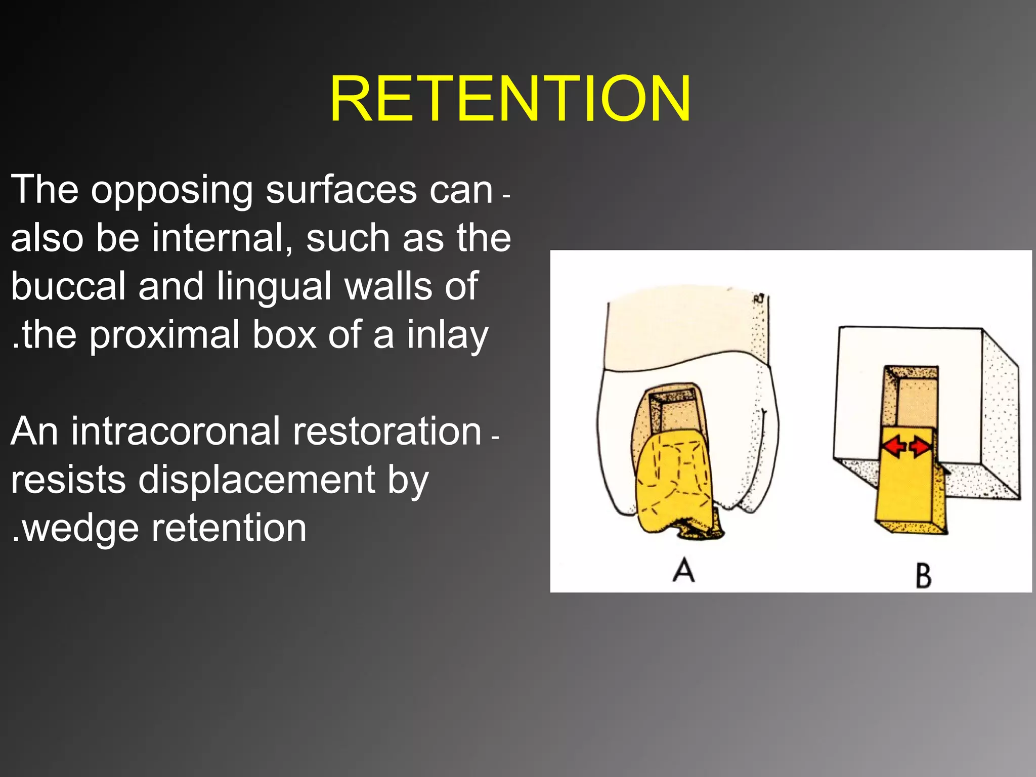 4.principles of tooth preparation ‫‬ | PPT