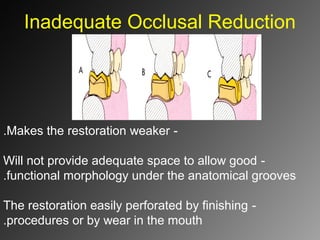 4.principles of tooth preparation ‫‬ | PPT | Oral care | Personal Care