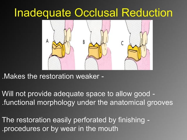 4.principles of tooth preparation ‫‬ | PPT | Oral care | Personal Care