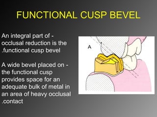 4.principles of tooth preparation ‫‬ | PPT | Oral care | Personal Care
