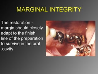 4.principles of tooth preparation ‫‬ | PPT | Oral care | Personal Care