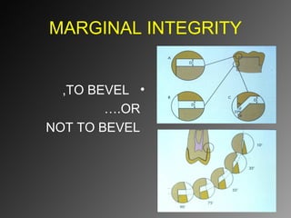 4.principles of tooth preparation ‫‬ | PPT | Oral care | Personal Care