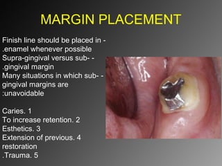 4.principles of tooth preparation ‫‬ | PPT | Oral care | Personal Care