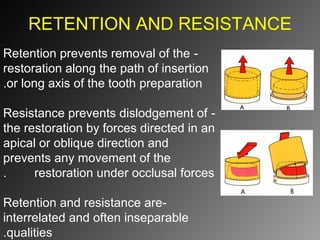 4.principles of tooth preparation ‫‬ | PPT | Oral care | Personal Care