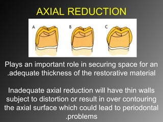4.principles of tooth preparation ‫‬ | PPT