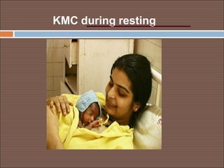 kmc Kanagaro mother care | PPT