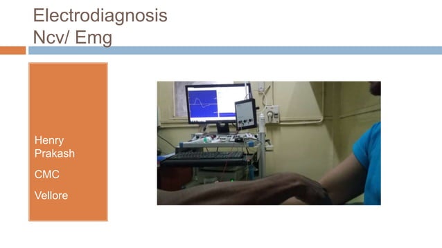 electrodiagnostics for pmr - dr henry prakash | PPTX