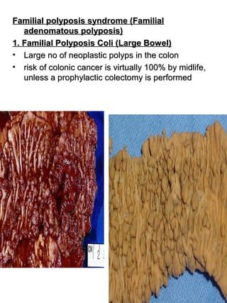 4.intestine3 | PPT