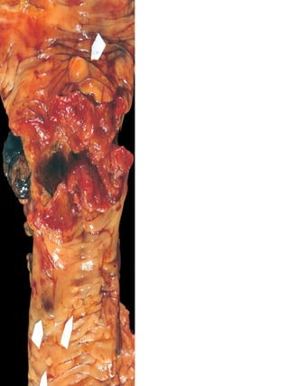 4.intestine3 | PDF