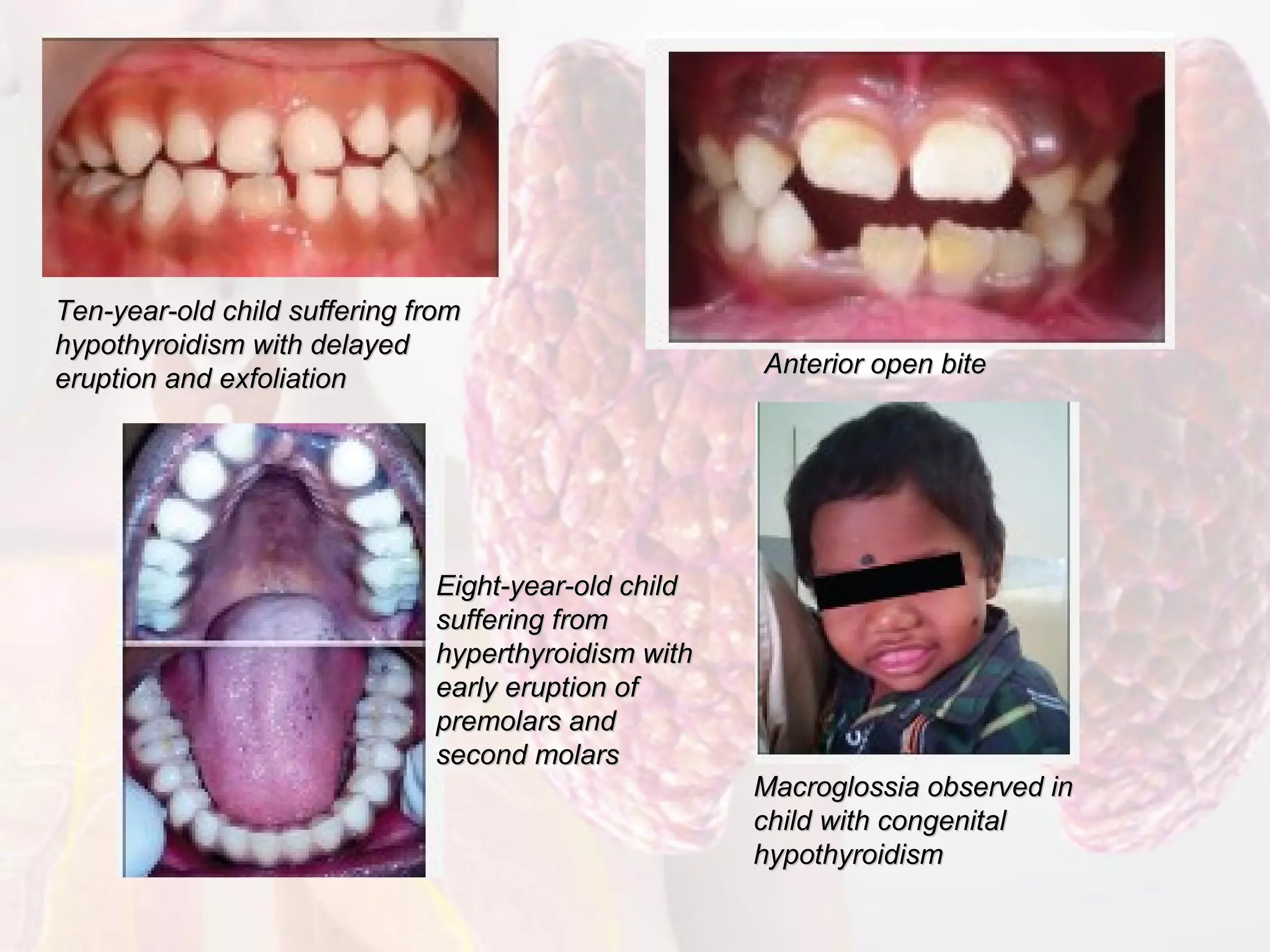 oral manifestations of systemic diseases | PPT