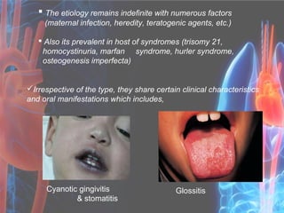 oral manifestations of systemic diseases | PPT