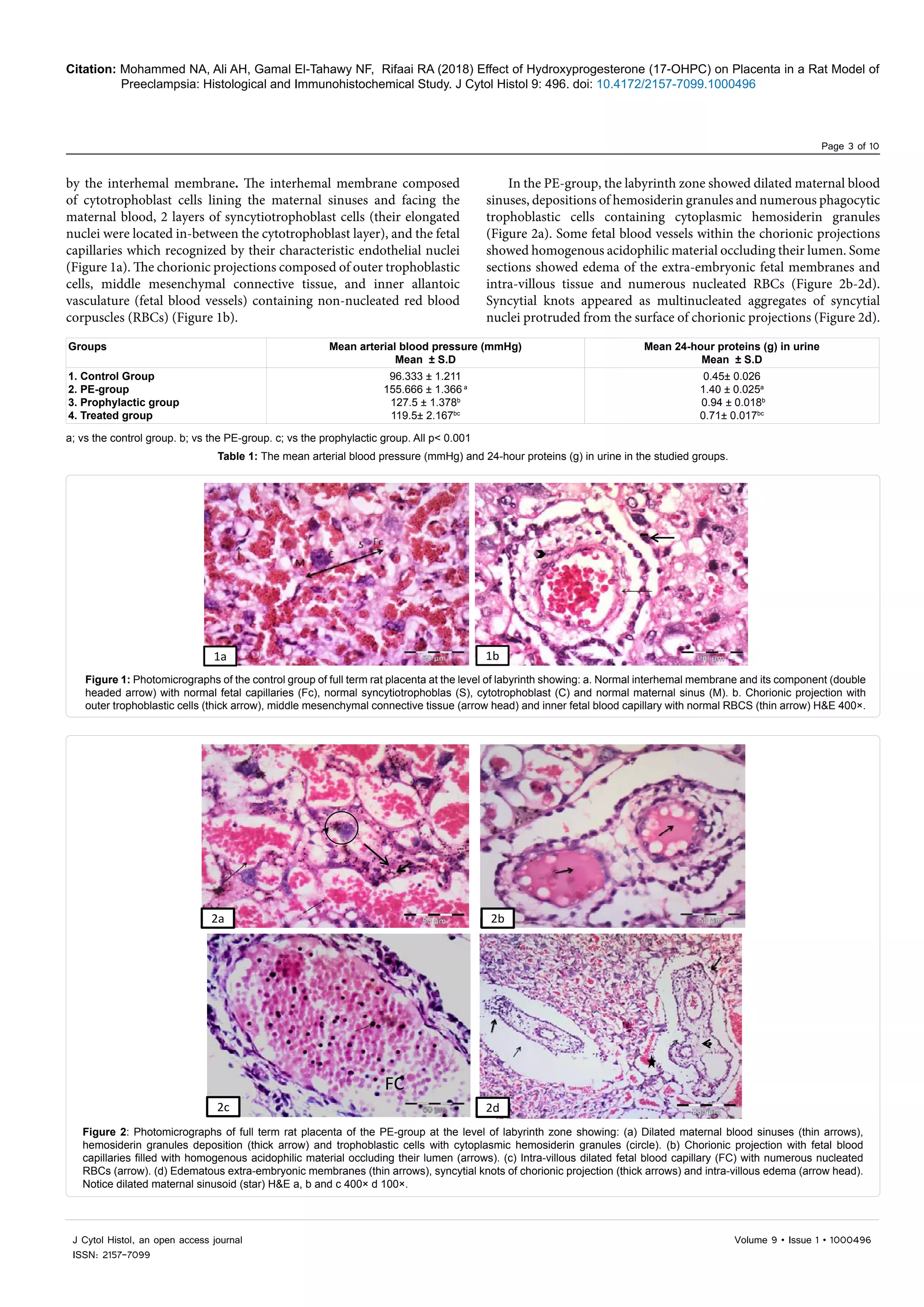 4. effect of-hydroxyprogesterone-17ohpc-on-placenta-in-a-rat-model-ofpreeclampsia-histological ...