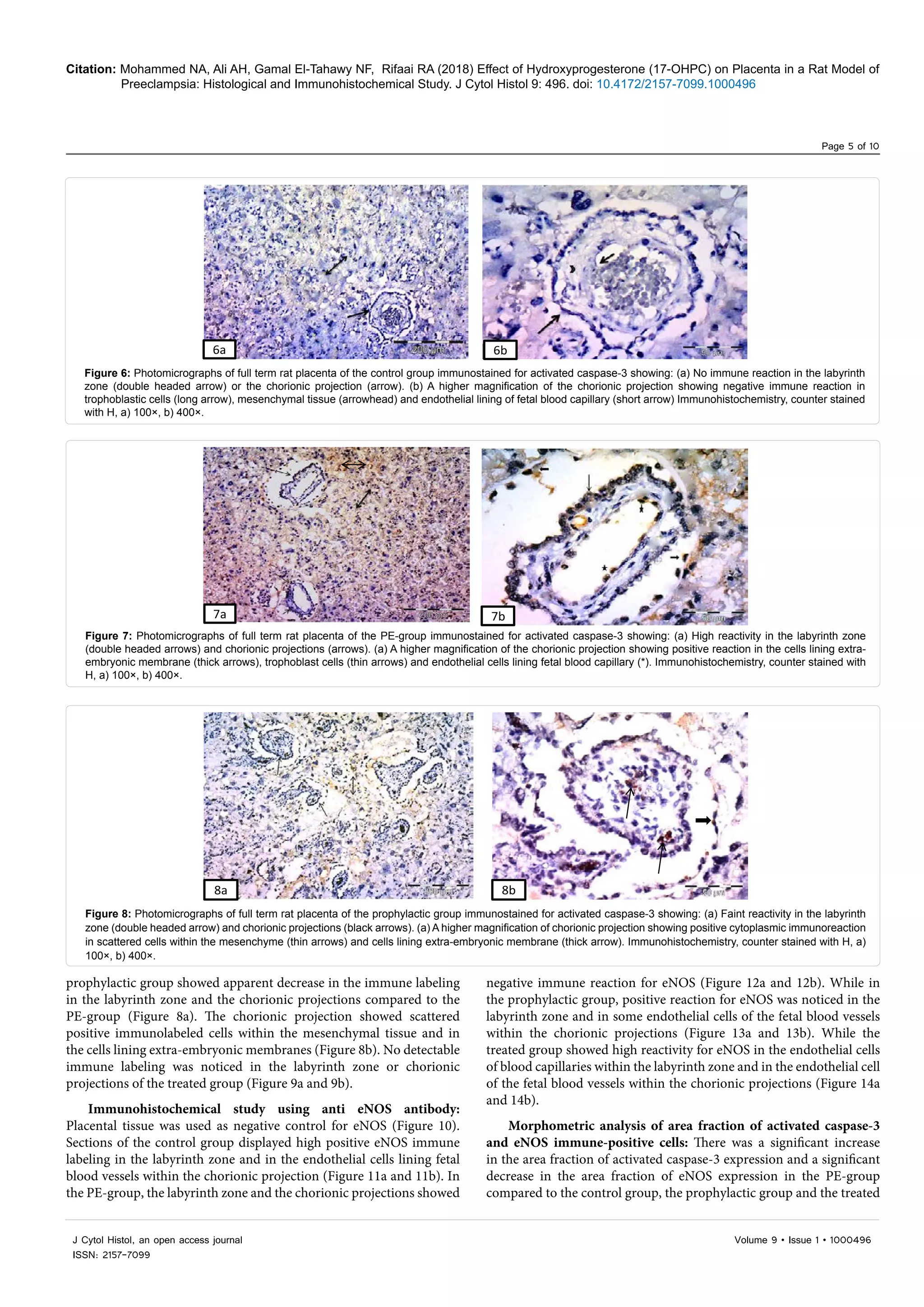 4. effect of-hydroxyprogesterone-17ohpc-on-placenta-in-a-rat-model-ofpreeclampsia-histological ...