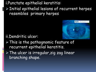 4.fungal and viral keratitis | PPTX