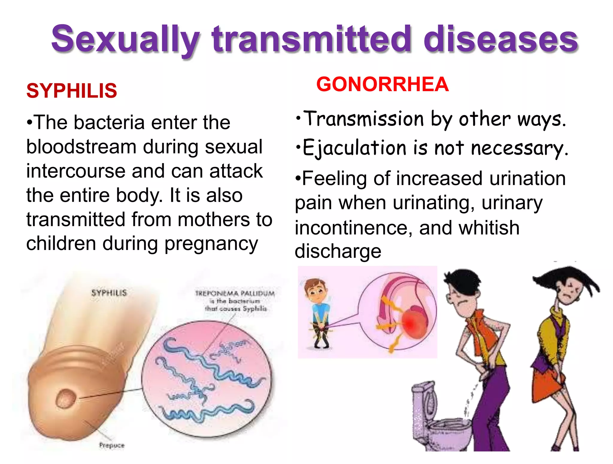 sexually transmitted disease | PPTX | Sexual Conditions | Sexual Health