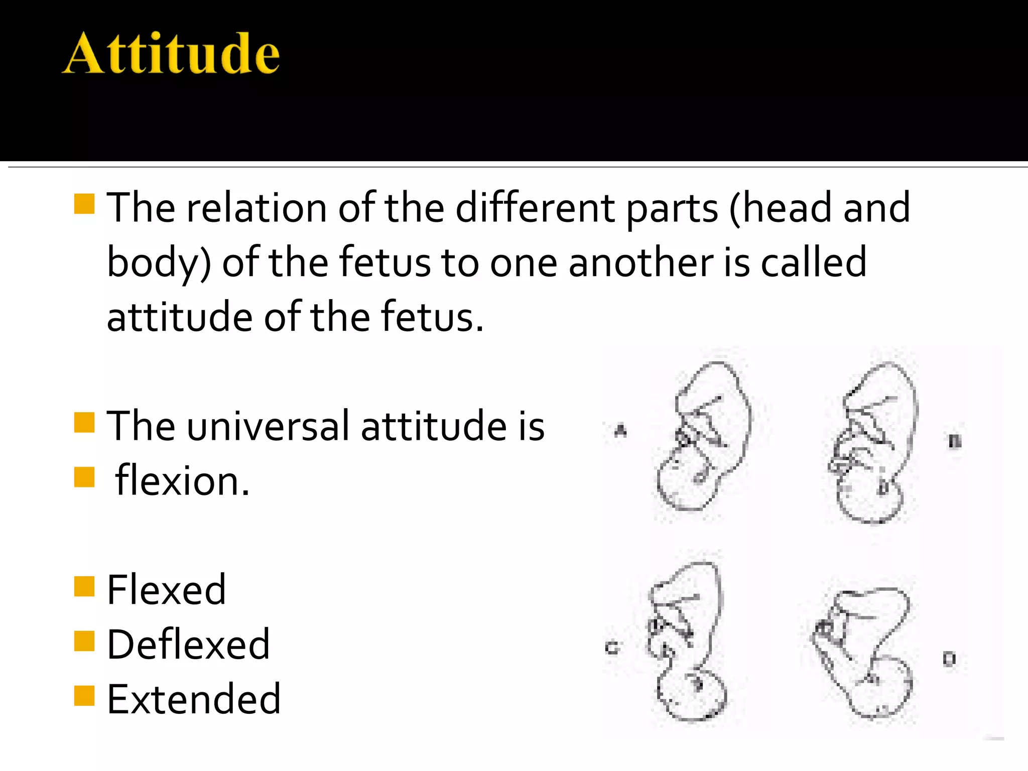 lie presentation-1 | PPT