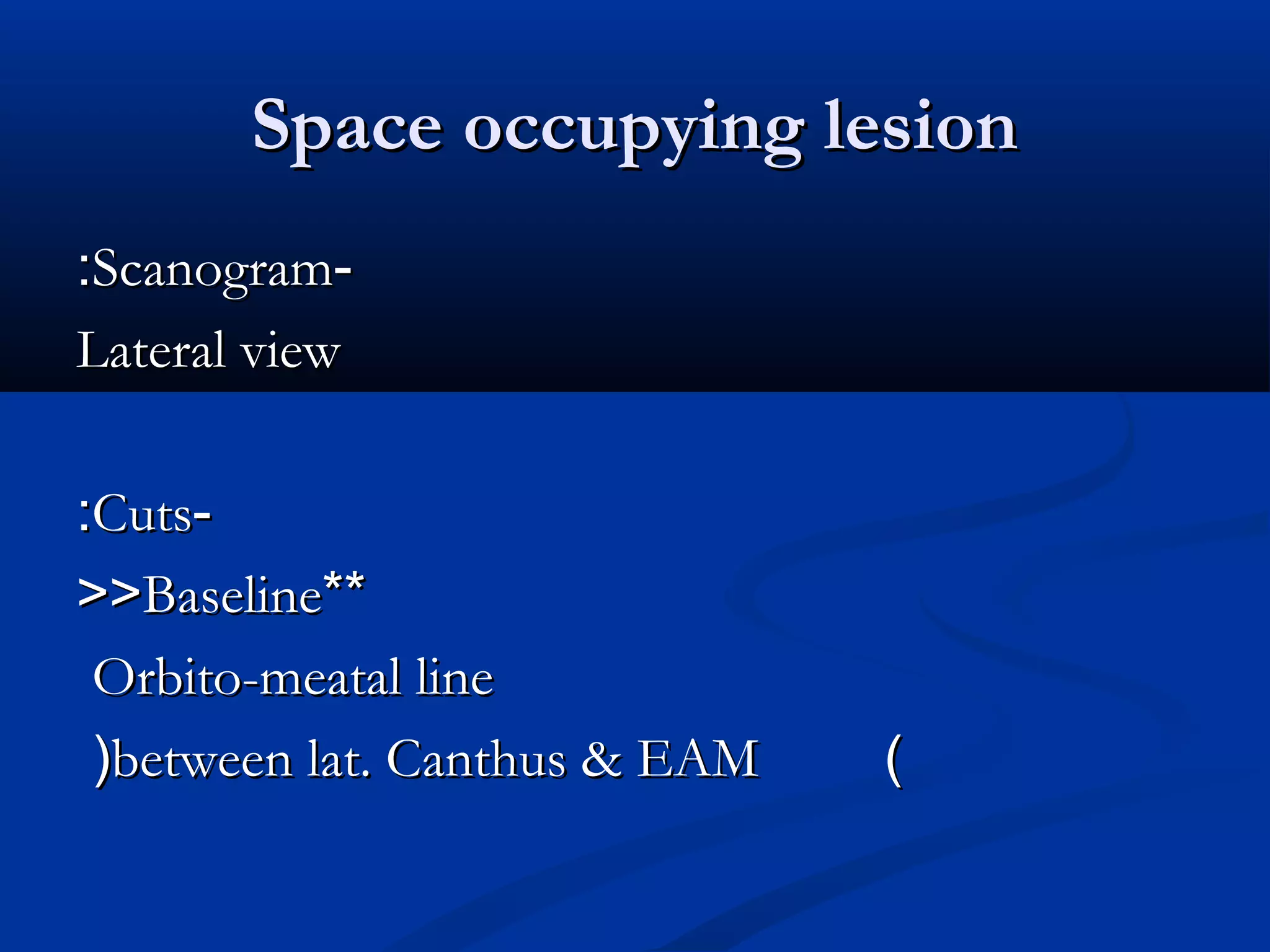 Radiological Techniques of brain Space occupying lesion | PPT