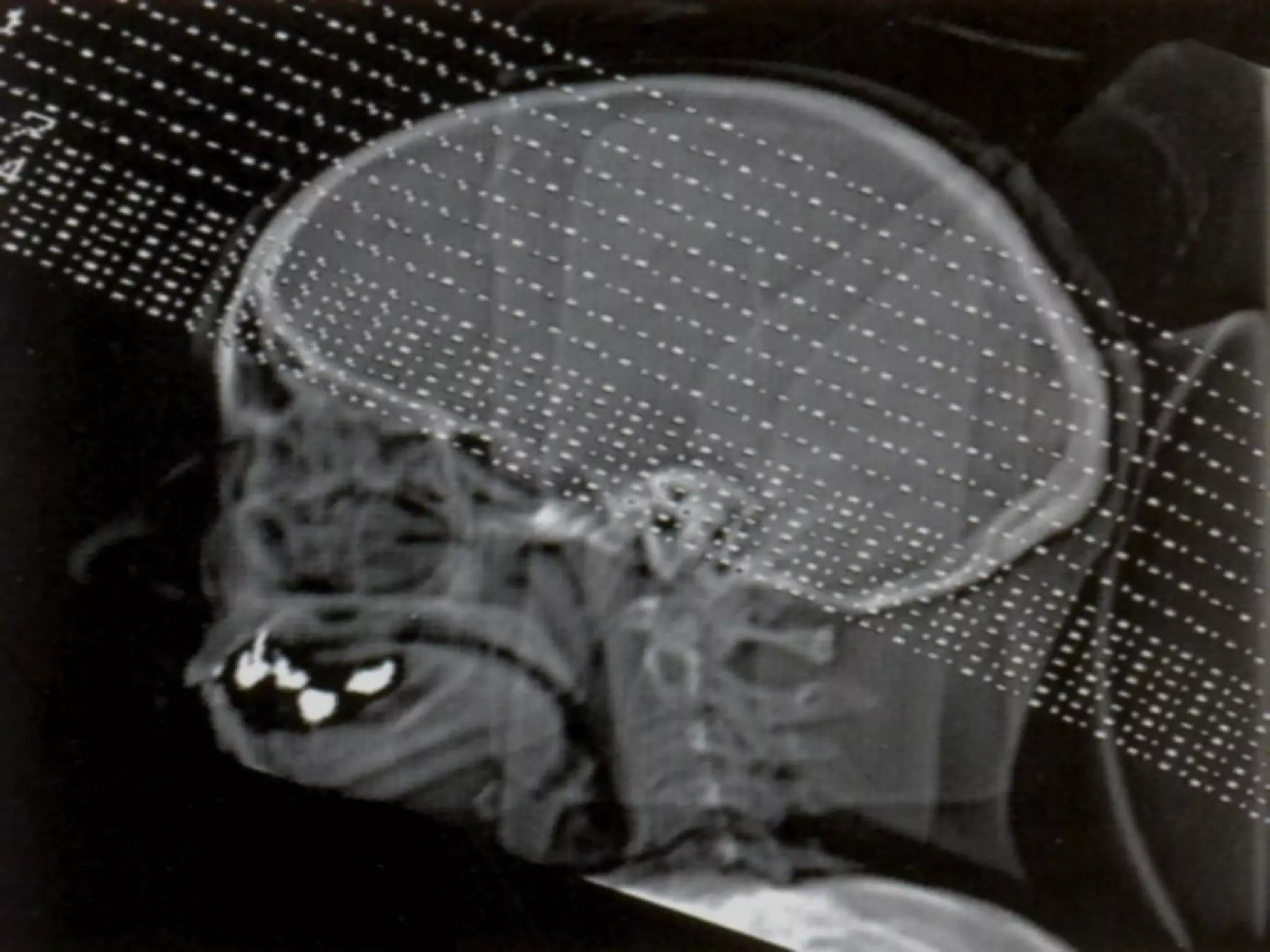 Radiological Techniques of brain Space occupying lesion | PPT