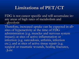 Radiological Techniques of brain Space occupying lesion | PPT