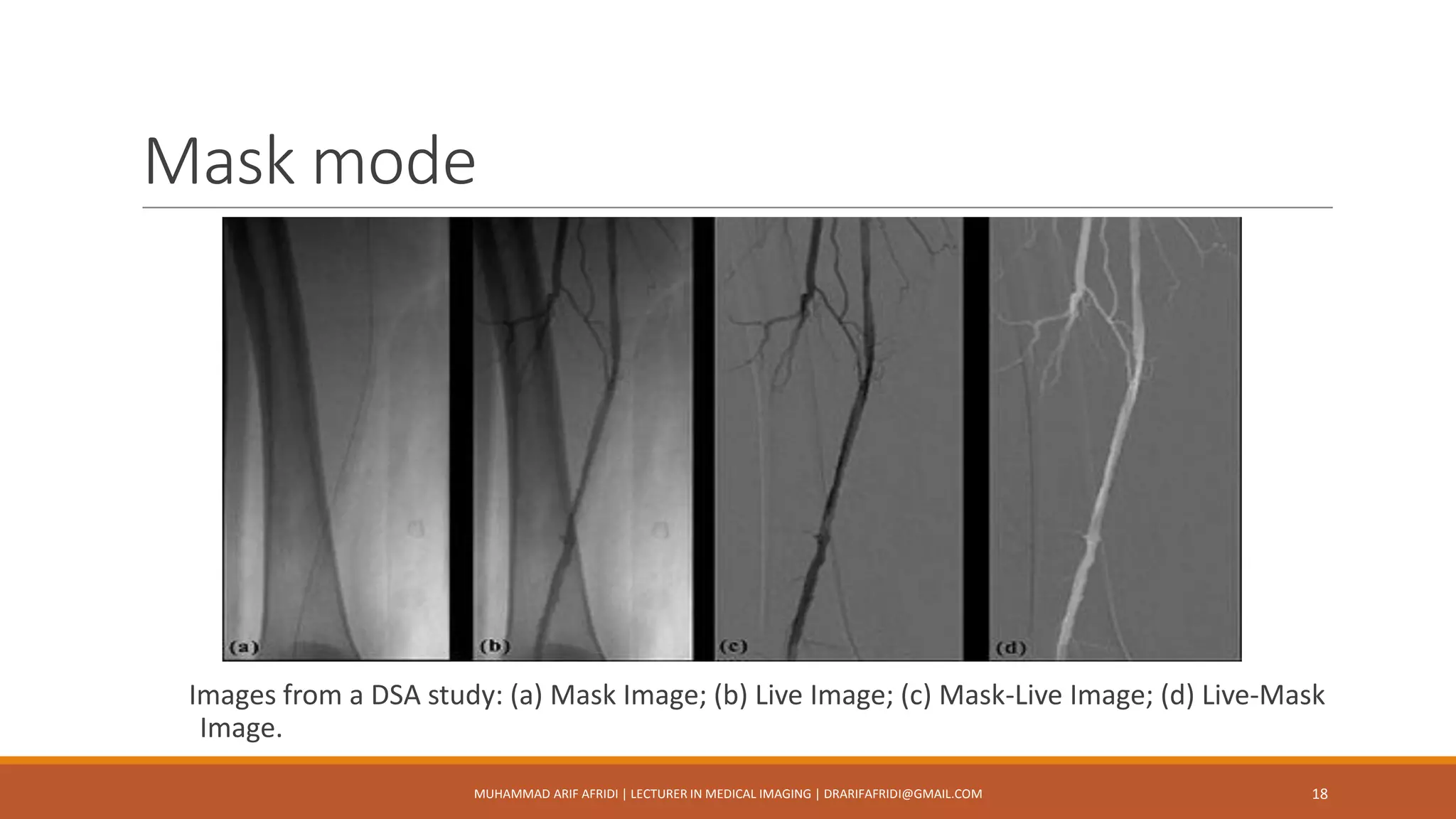 Digital Fluoroscopy Imaging System | PDF