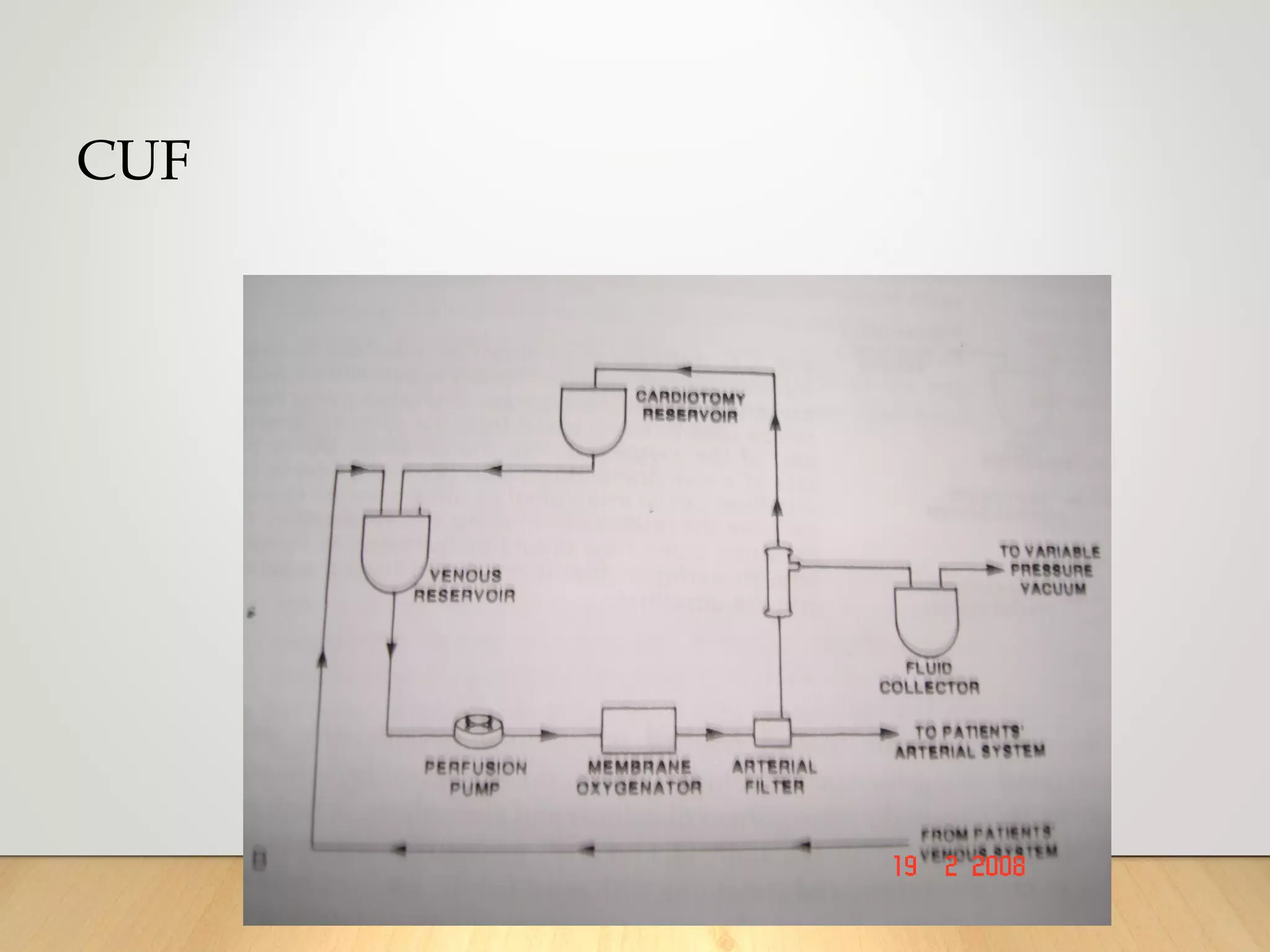 4.hemo filtration & blood conservation technique | PPT