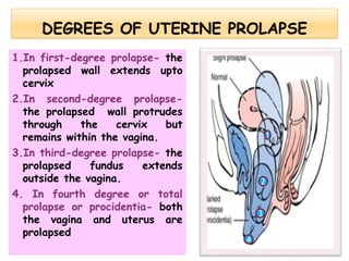 UTERINE DISPLACEMENT | PPTX