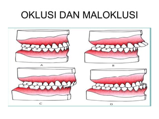 4.oklusi | PPT