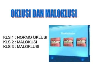 4.oklusi | PPT