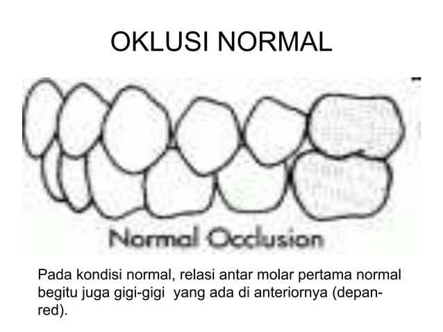 4.oklusi | PPT