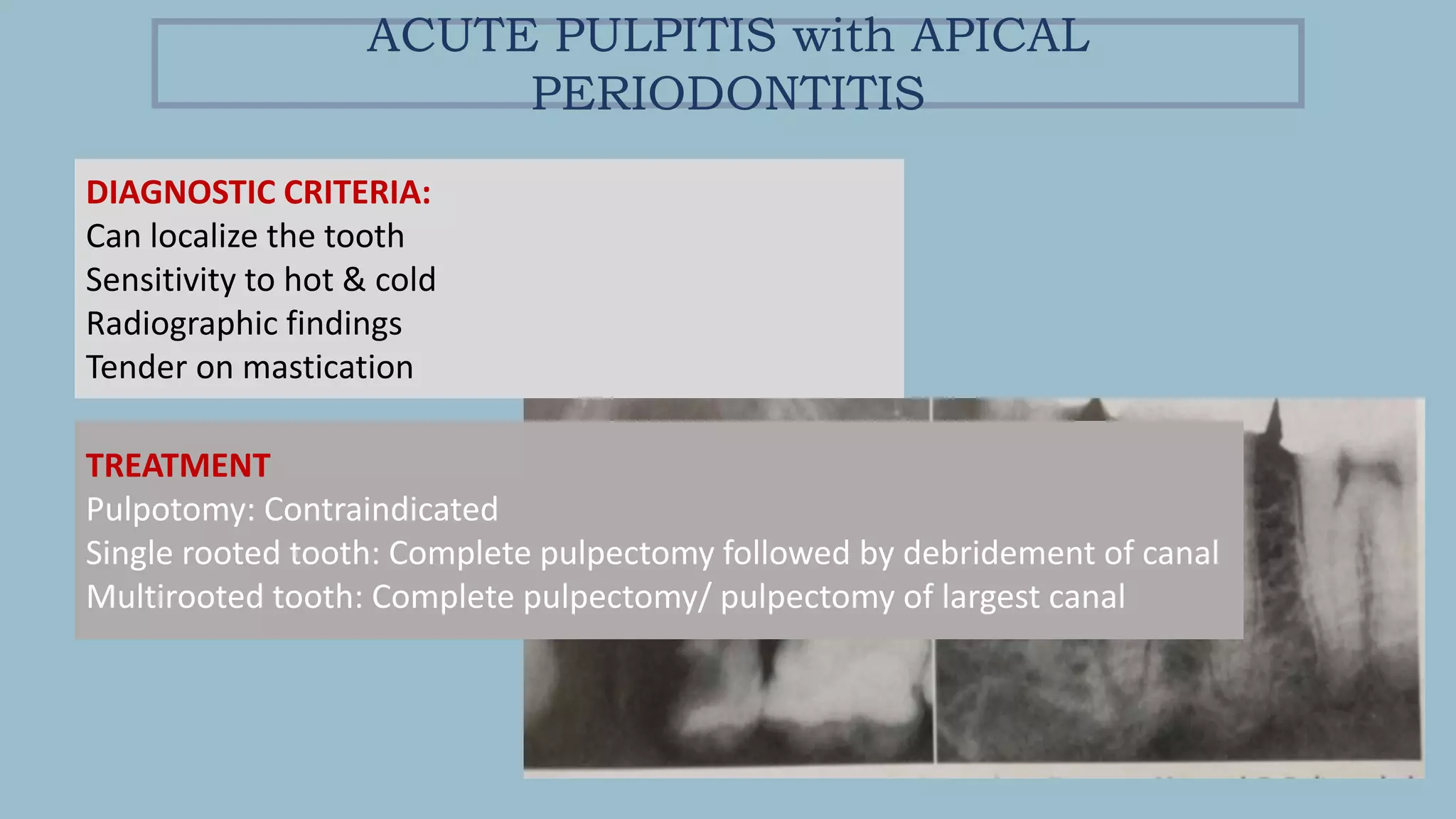 Endodontic emergencies | PPTX