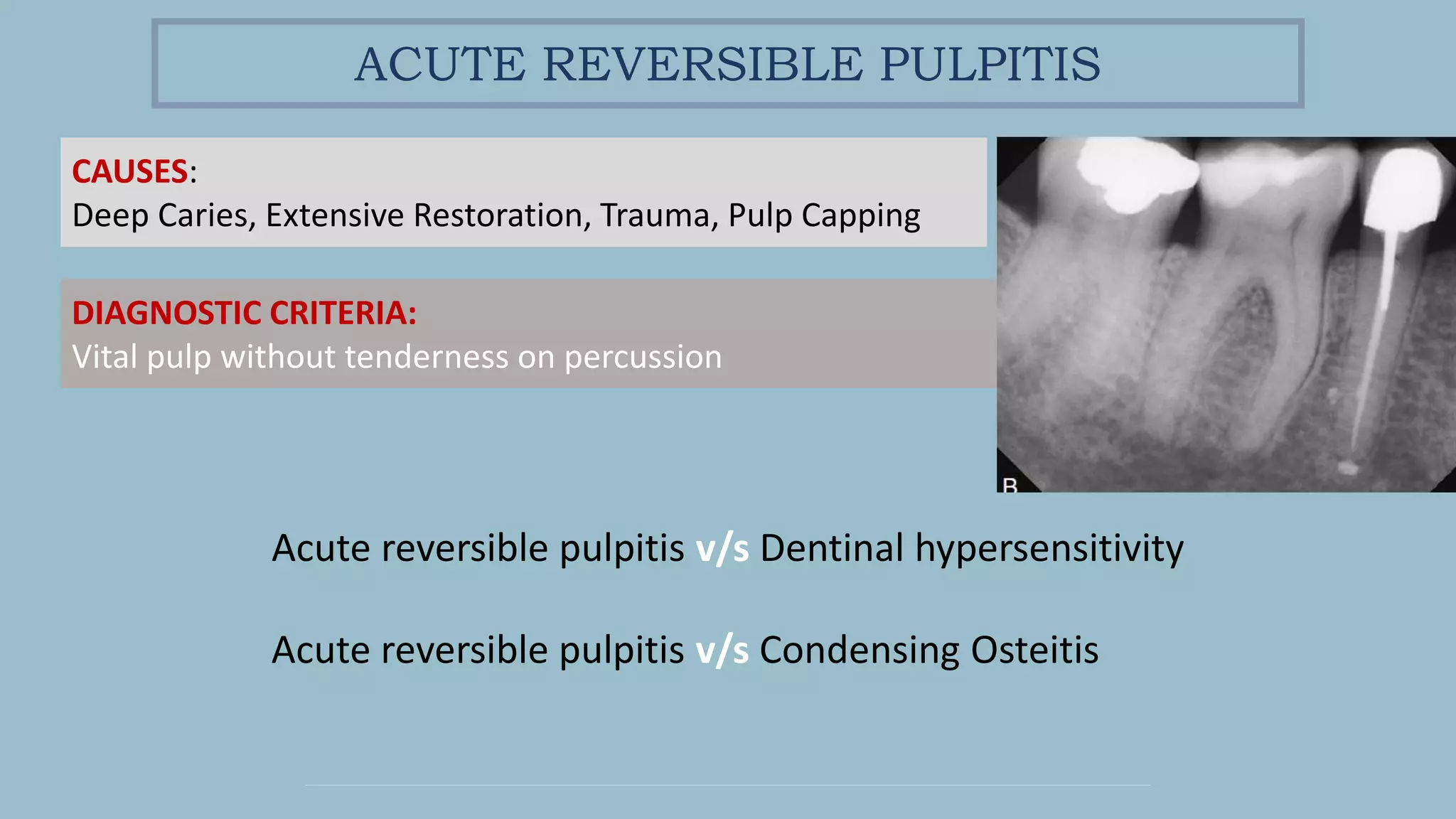 Endodontic emergencies | PPTX