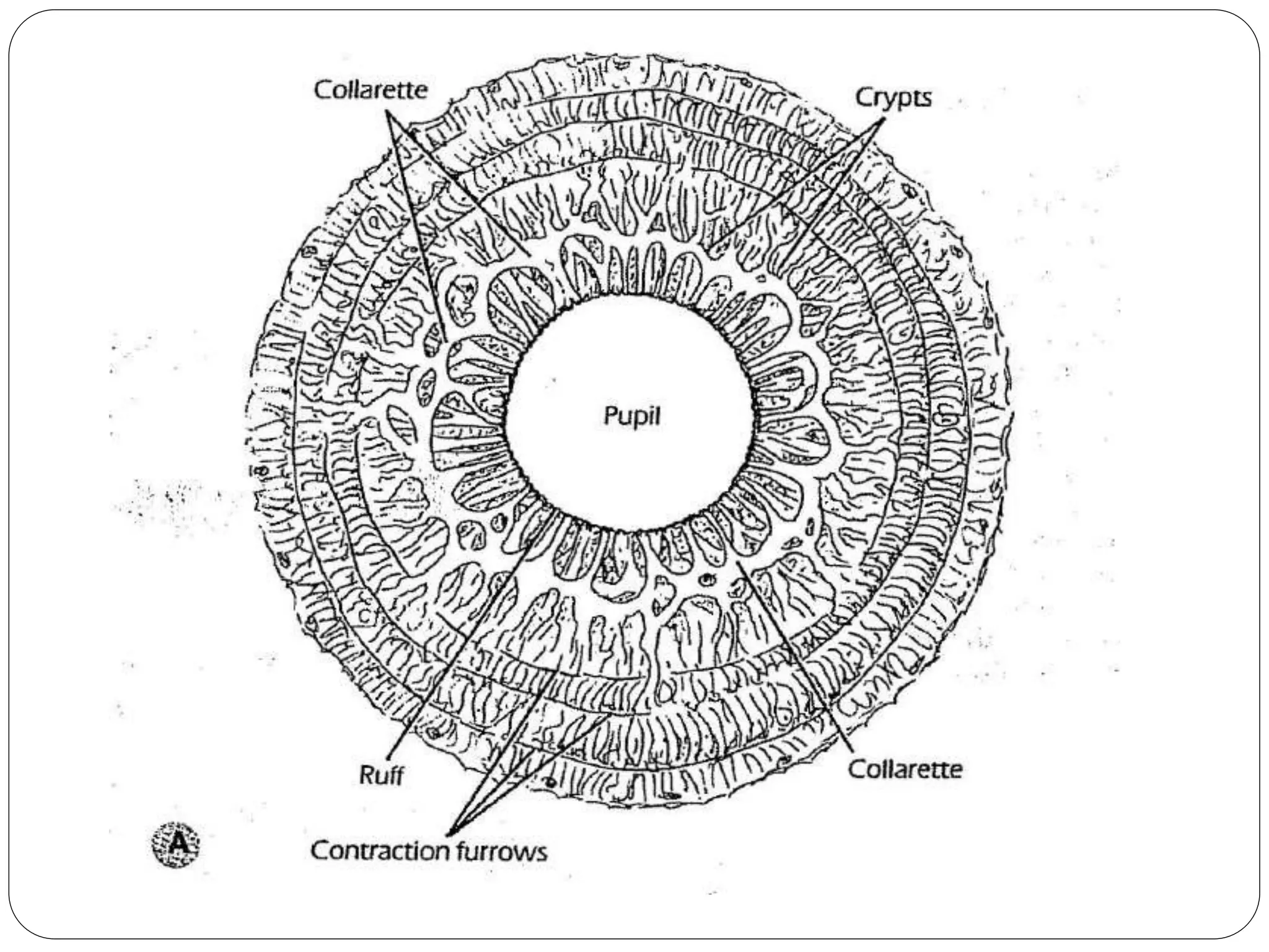 Anatomy of uvea tract(iris, ciliary body and choroid) | PPTX
