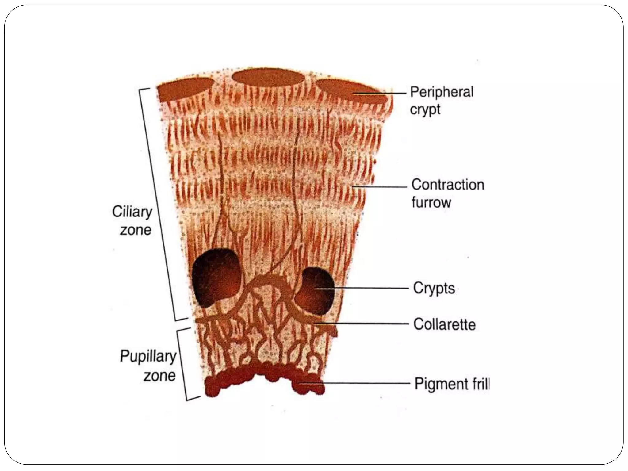 Anatomy of uvea tract(iris, ciliary body and choroid) | PPTX
